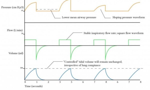 Pressure vs Volume Controlled Ventilation | Critical Care Insights